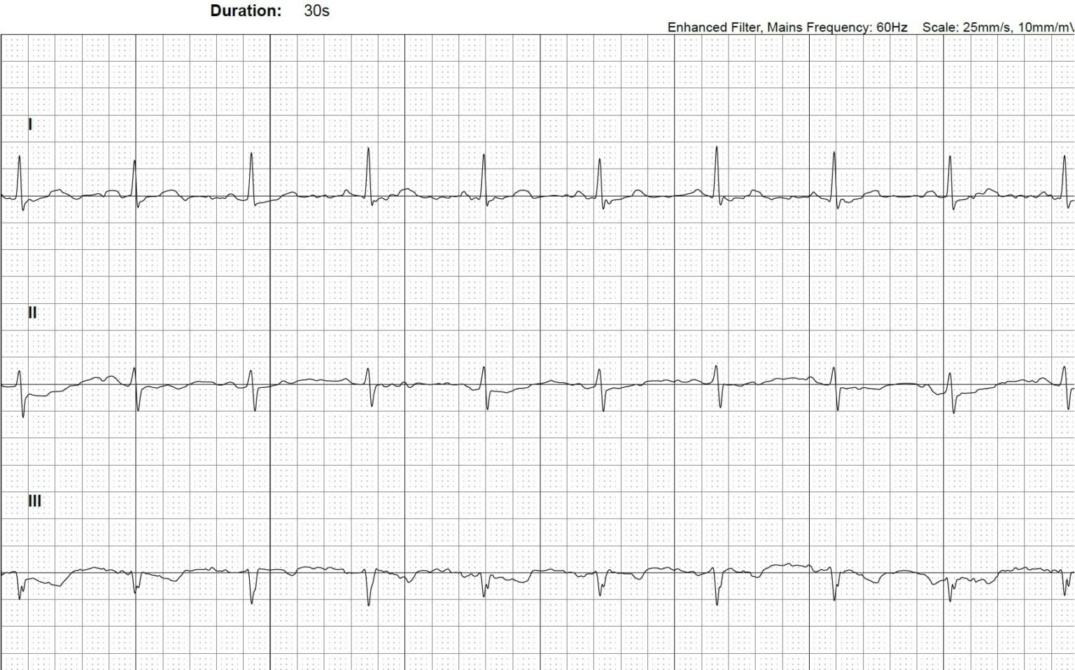 10 Best Portable EKG Monitors with Smartphone Integration (March 2026)